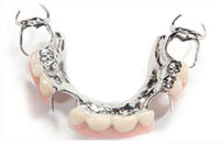 Le stellite reconstitution amovible - Dr David - Dentiste Thiais